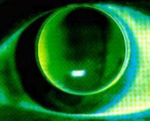 Ncle Fluorescein Staining Fitting Patterns Optical Nerd